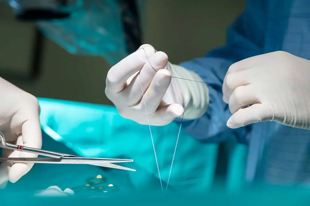 Understanding How Long Do Dissolvable Stitches Last After Vet Surgery